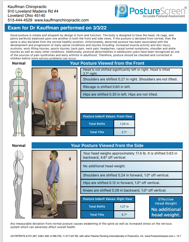 Free Posture Analysis with Every New Patient Appointment | Loveland, OH Chiropractor | Kauffman ...