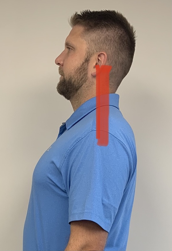 Radiating Pain vs. Referred Pain | Loveland, OH Chiropractor | Kauffman ...